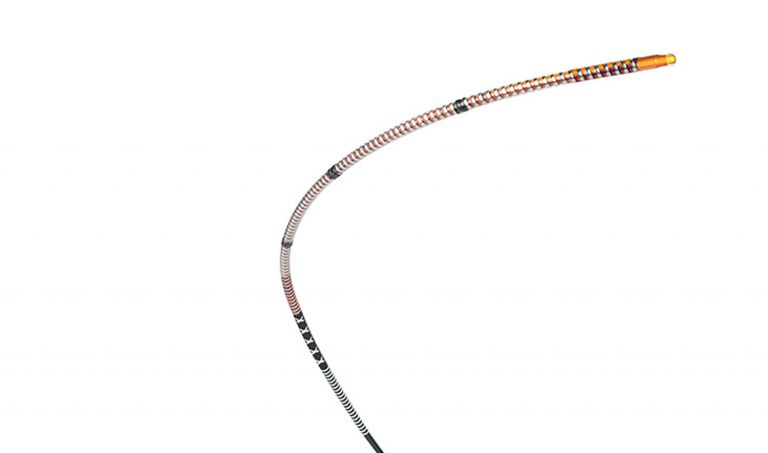 Radiofrequency Ablation RFA - Varicose Veins Treatment